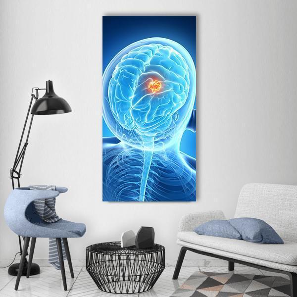 Brain Tumor Illustration with Glowing Core Vertical Canvas Wall Art ...